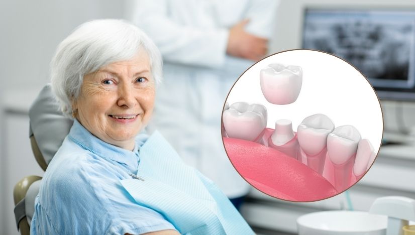 Age-Related Tooth Damage? Dental Crowns Can Help